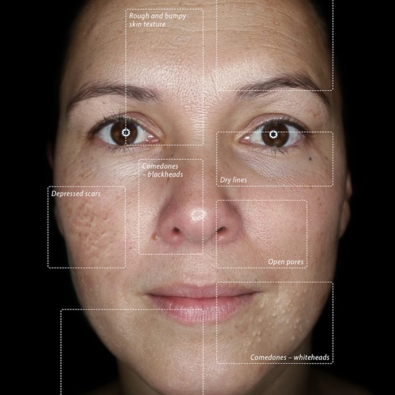 OBSERV 520 Skin Analysis - You by Dr Shauna Watts